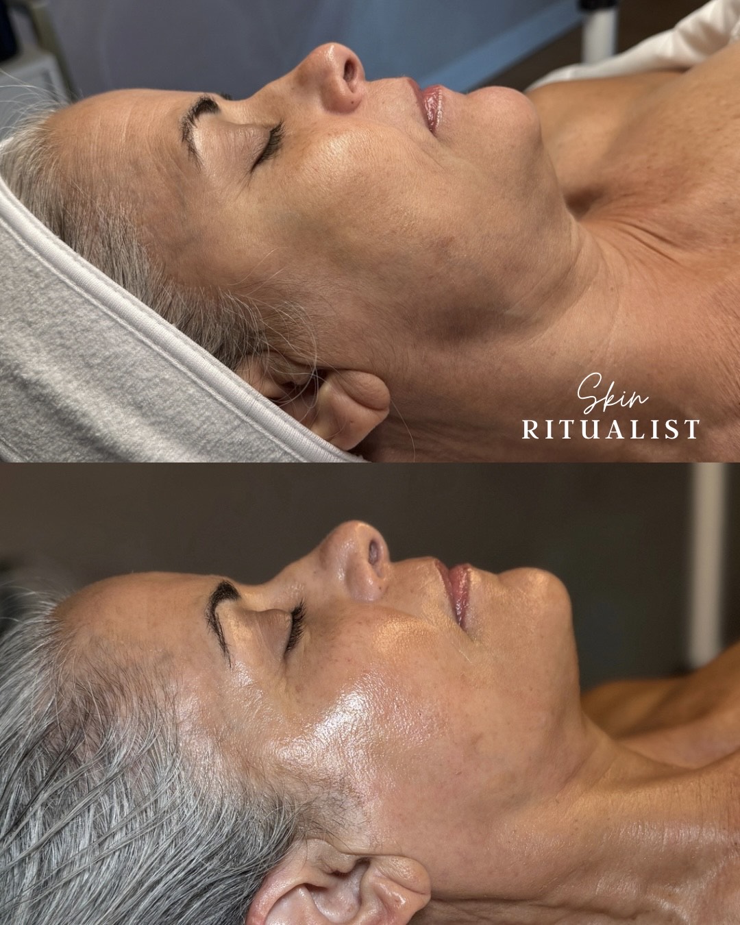 Facial Spa Treatment Fort Lauderdale | Skin Ritualist